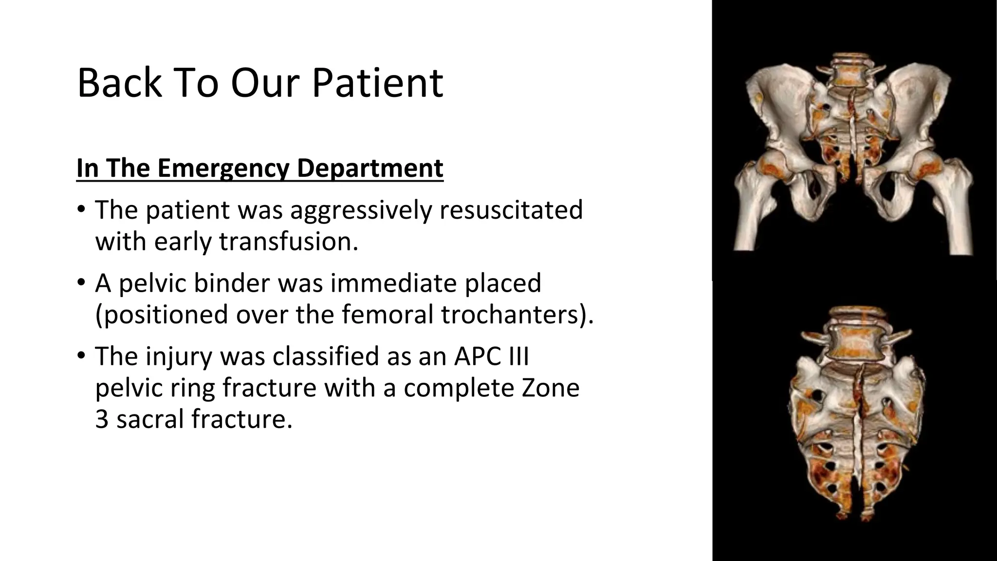 Adult Orthopedic Imaging Mastery Project - Pelvic Ring Fractures | PPTX