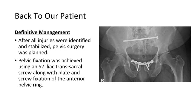 Adult Orthopedic Imaging Mastery Project - Pelvic Ring Fractures | PPTX