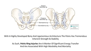 Adult Orthopedic Imaging Mastery Project - Pelvic Ring Fractures | PPTX
