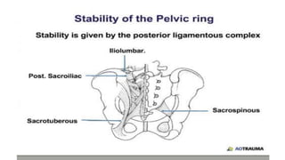Pelvic ring fractures | PPTX