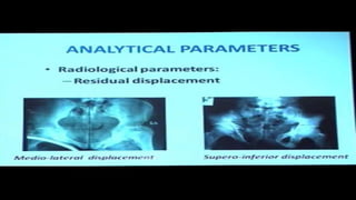 Pelvic ring fractures | PPTX