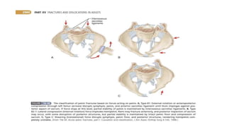 Pelvic ring fractures | PPTX