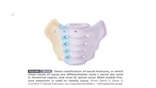 Pelvic ring fractures | PPTX