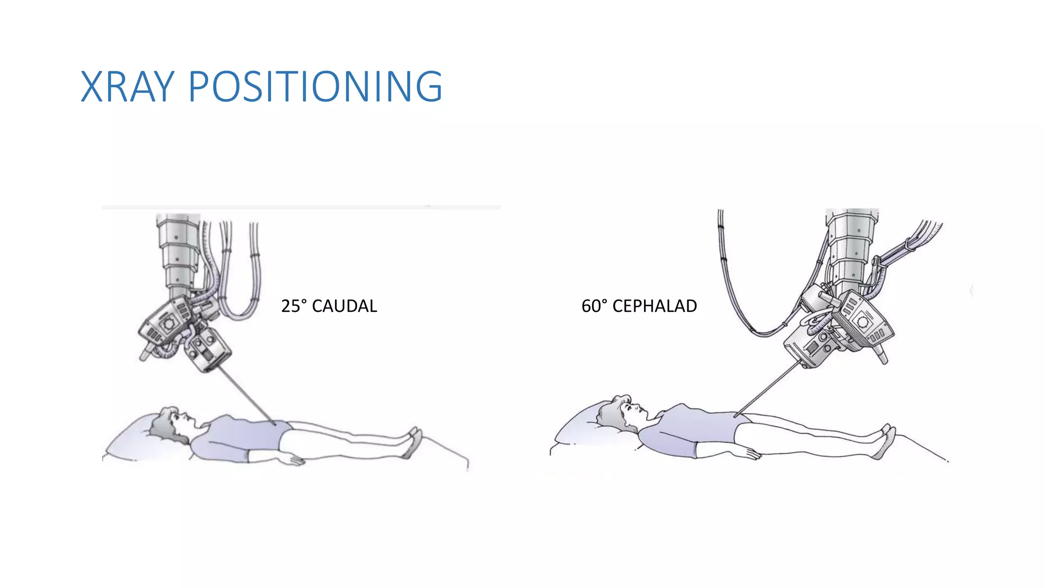 PELVIC RING FRACTURES | PPTX