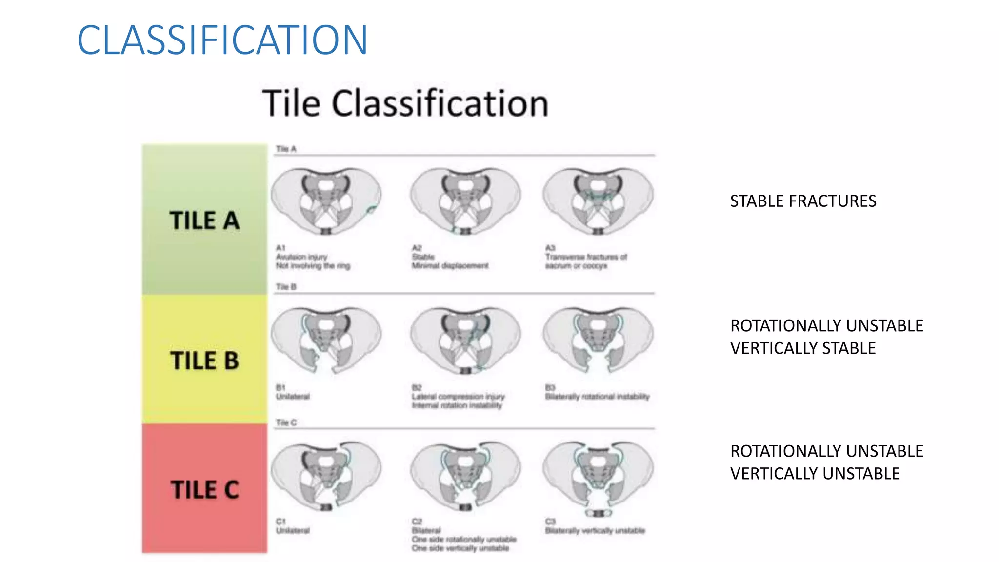 PELVIC RING FRACTURES | PPTX