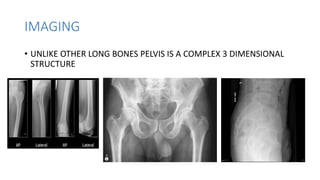 PELVIC RING FRACTURES | PPTX