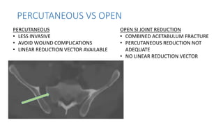 PELVIC RING FRACTURES | PPTX
