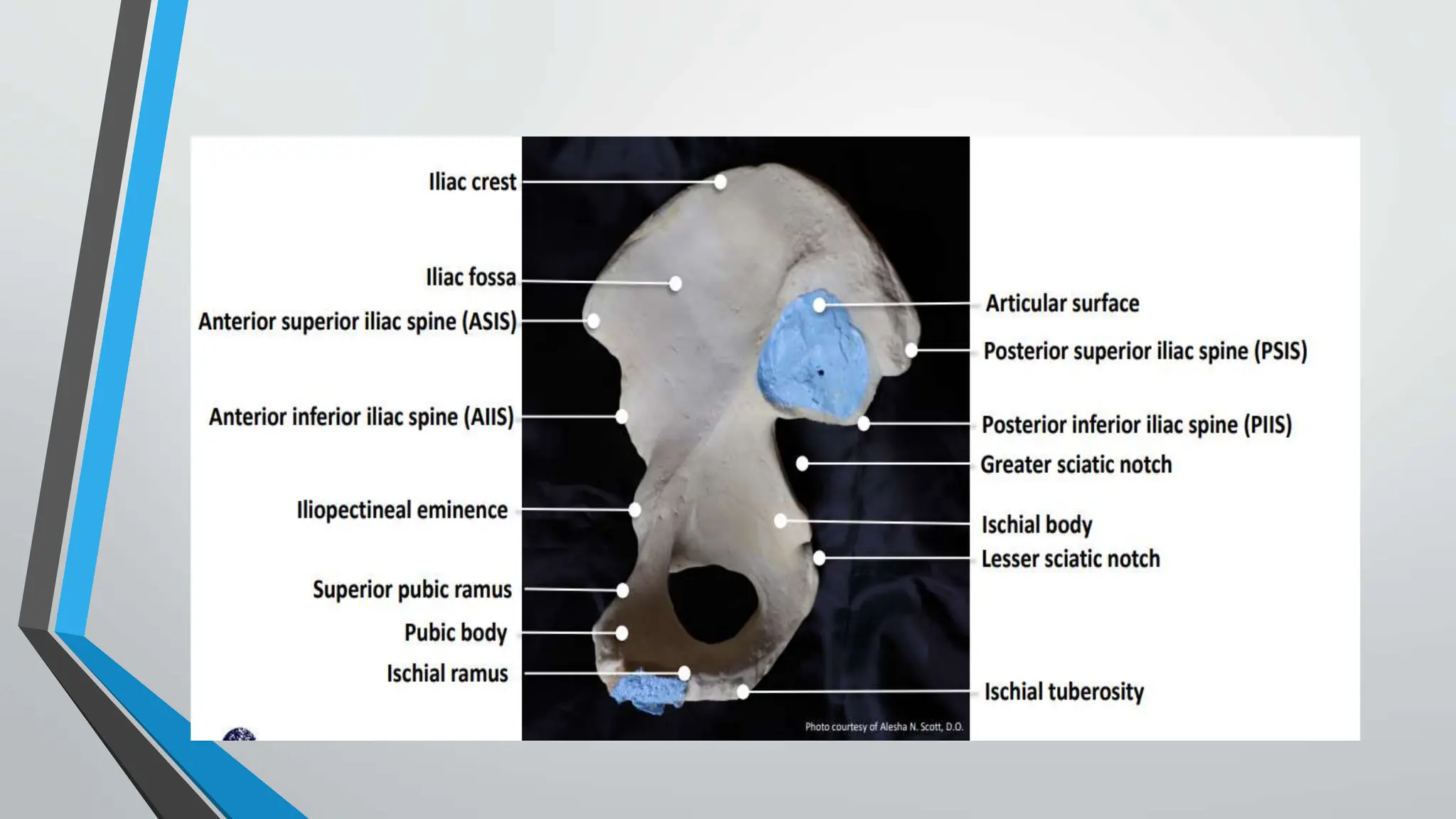 PELVIC RING FRACTURES AND CLASSIFICATIONS.pptx