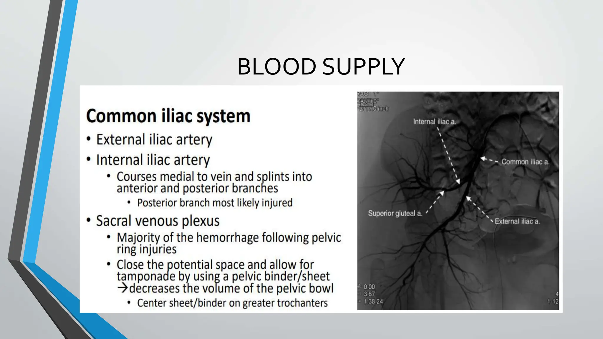PELVIC RING FRACTURES AND CLASSIFICATIONS.pptx