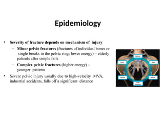 Pelvic Ring Injury diagnosis and management.pptx