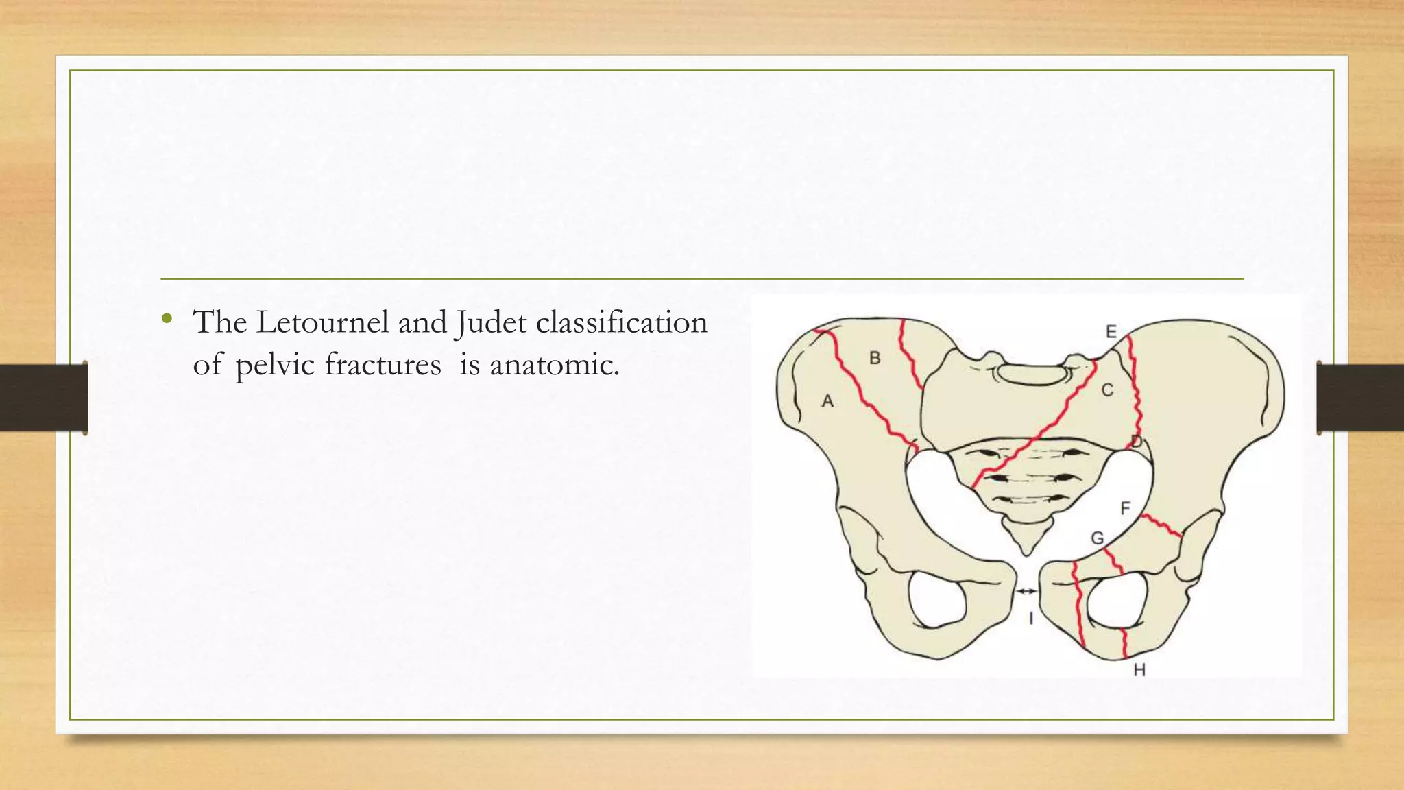 pelvic ring injury seminar 1.pptx