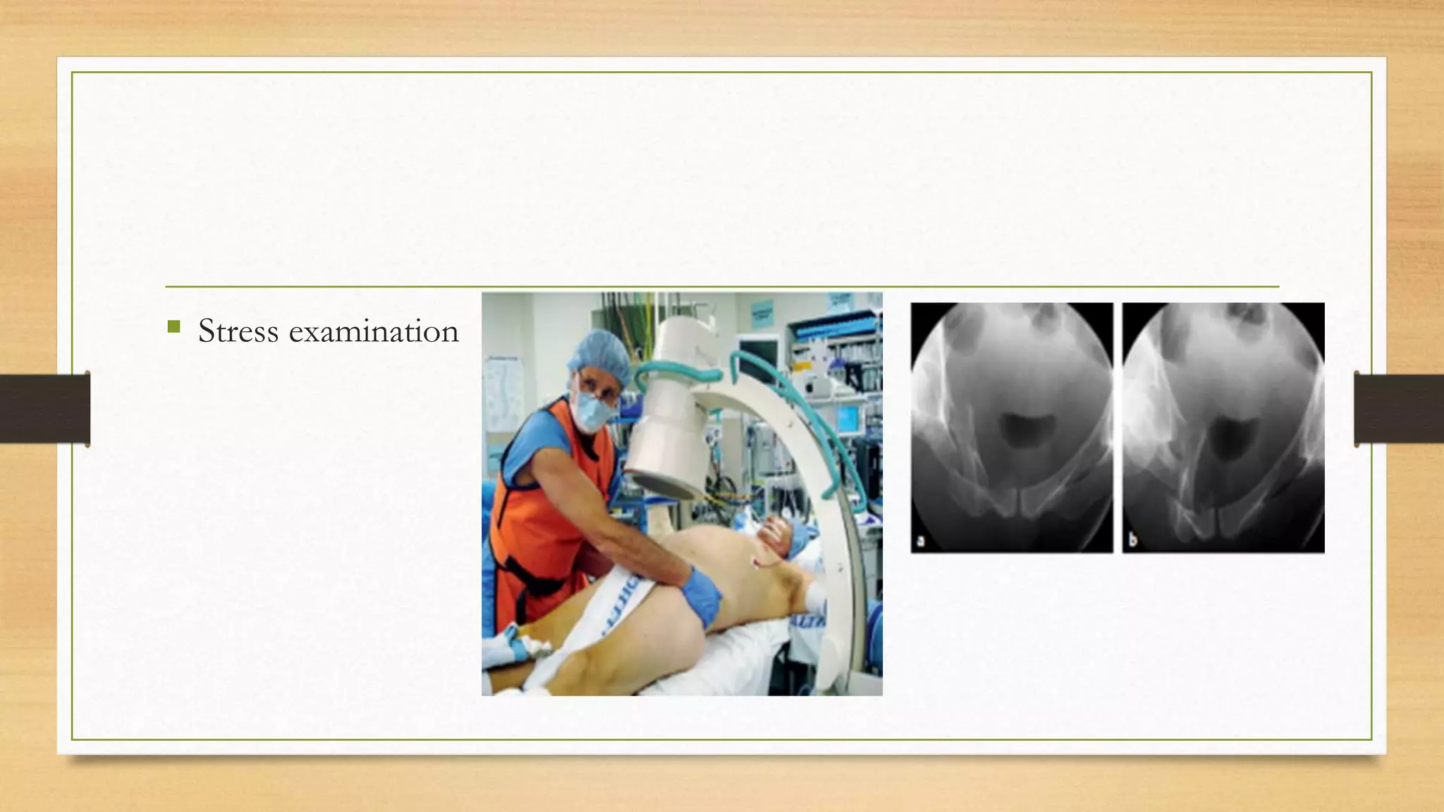 PELVIC RING INJURY | PPTX