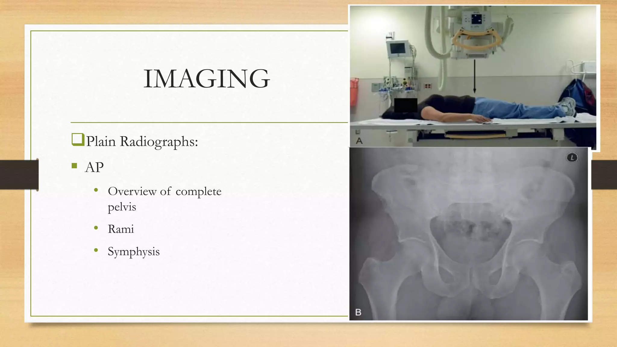 PELVIC RING INJURY | PPTX