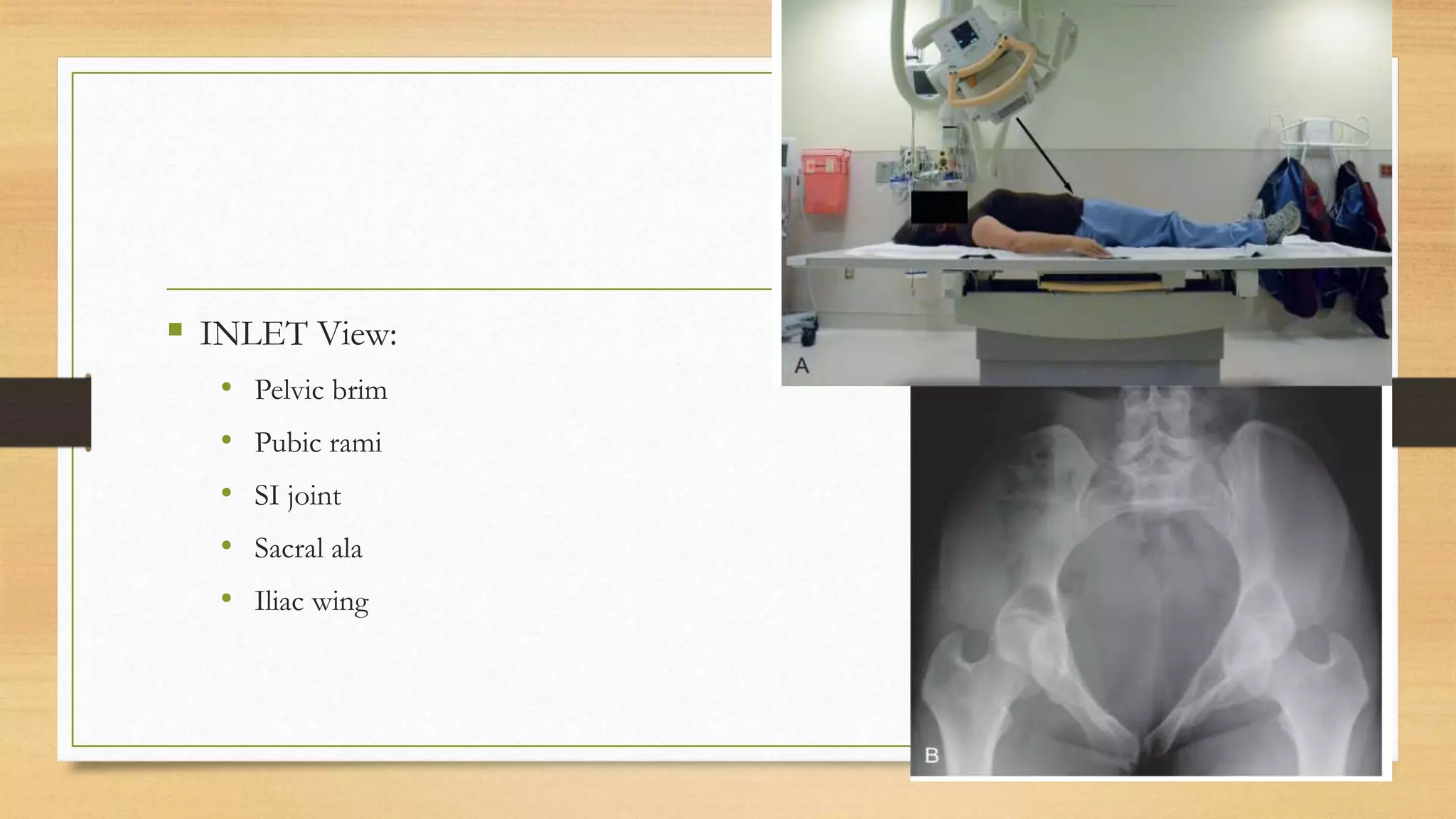 PELVIC RING INJURY | PPTX