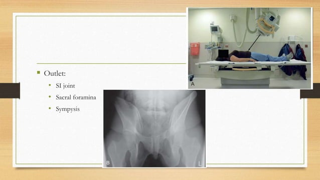 PELVIC RING INJURY | PPTX