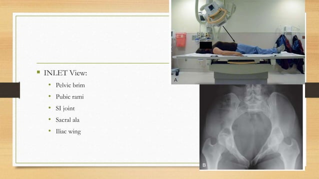 PELVIC RING INJURY | PPTX