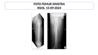 Pelvic ring injury Tile classification A2 dengan hemodynamic stabil ...
