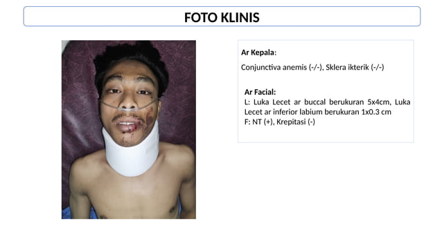 Pelvic ring injury Tile classification A2 dengan hemodynamic stabil ...