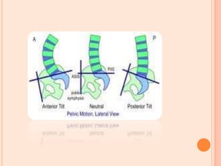 Pelvic tilt | PPTX