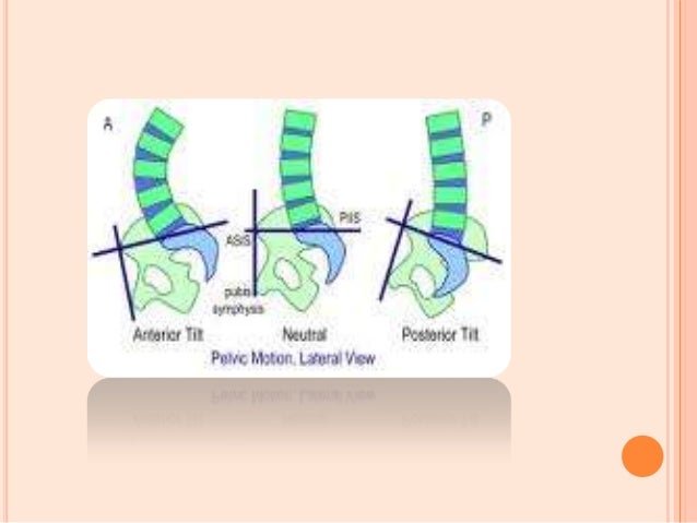 Pelvic tilt