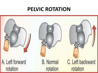 Pelvic tilt | PPTX