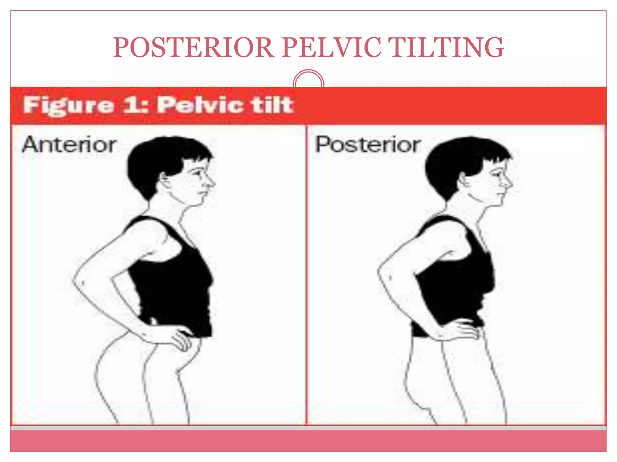 Pelvic Tilt | PPTX
