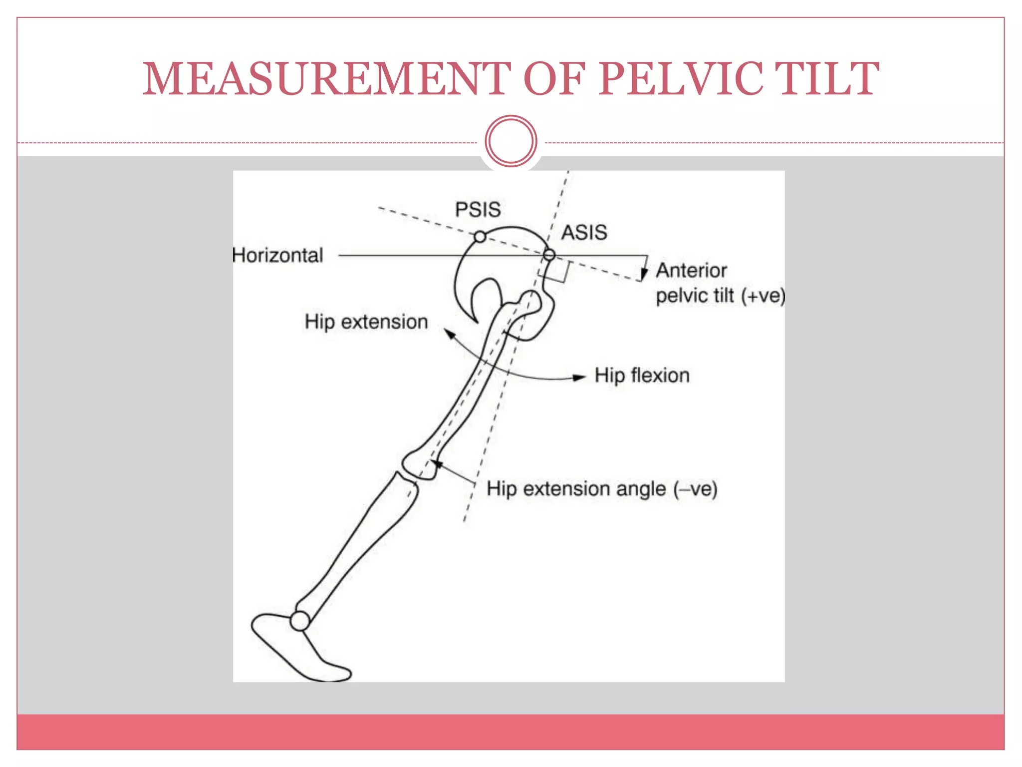 Pelvic Tilt | PPTX