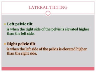 Pelvic Tilt | PPTX