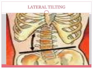Pelvic Tilt | PPTX