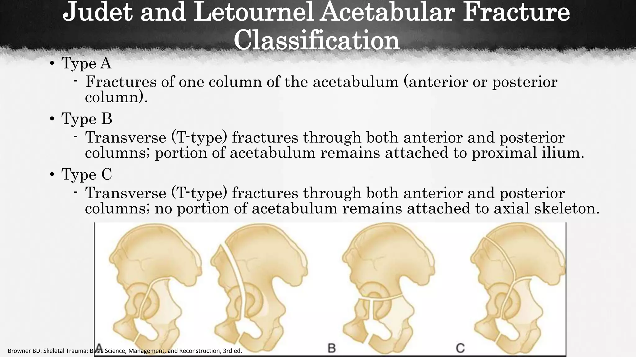 Pelvic trauma | PPTX