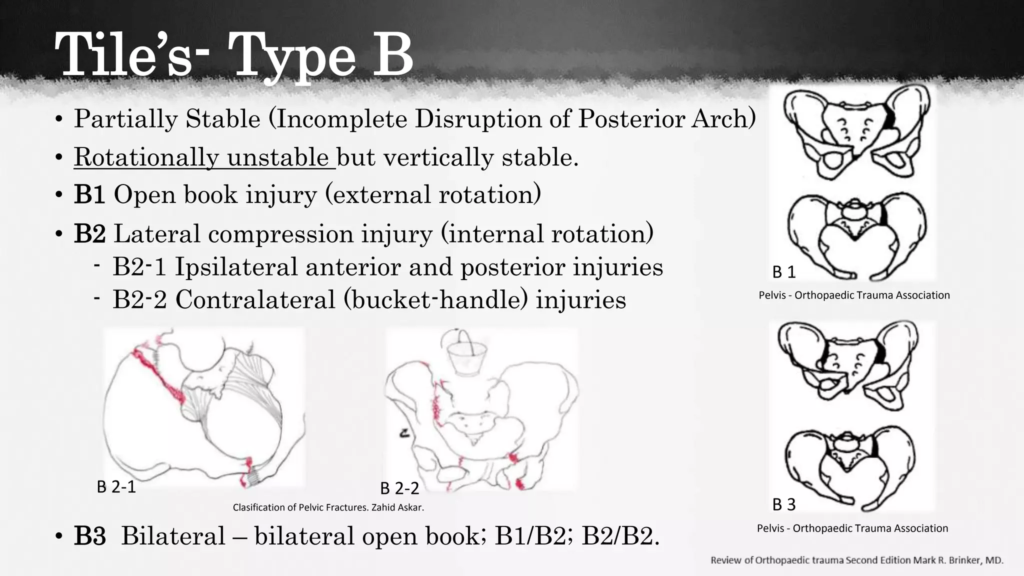 Pelvic trauma | PPTX