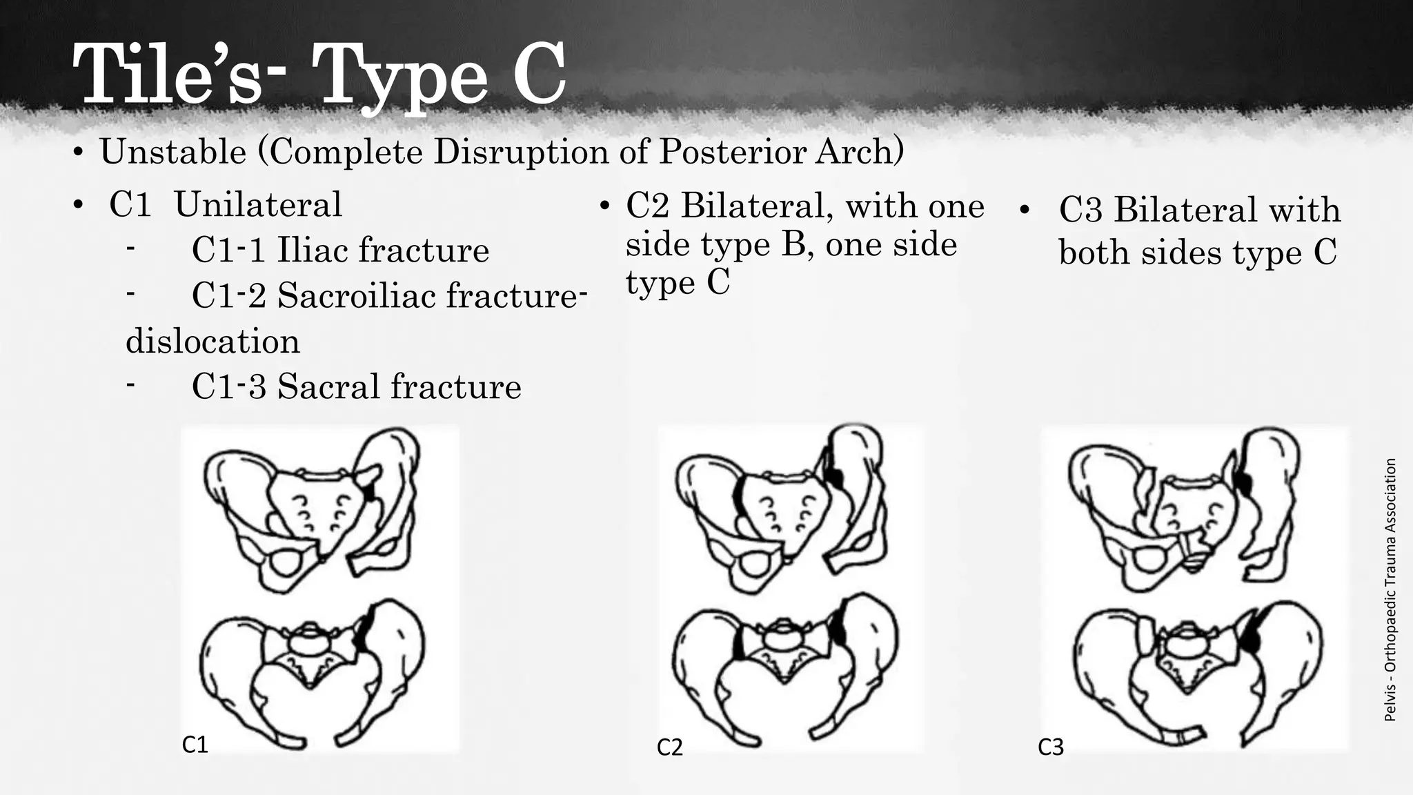 Pelvic trauma | PPTX
