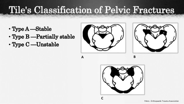 Pelvic trauma