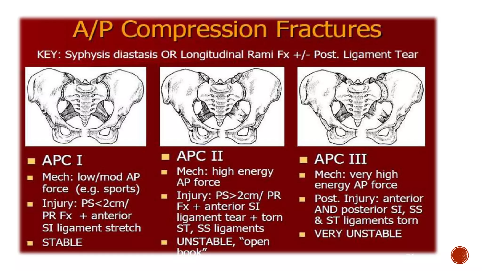 Pelvic trauma | PPTX