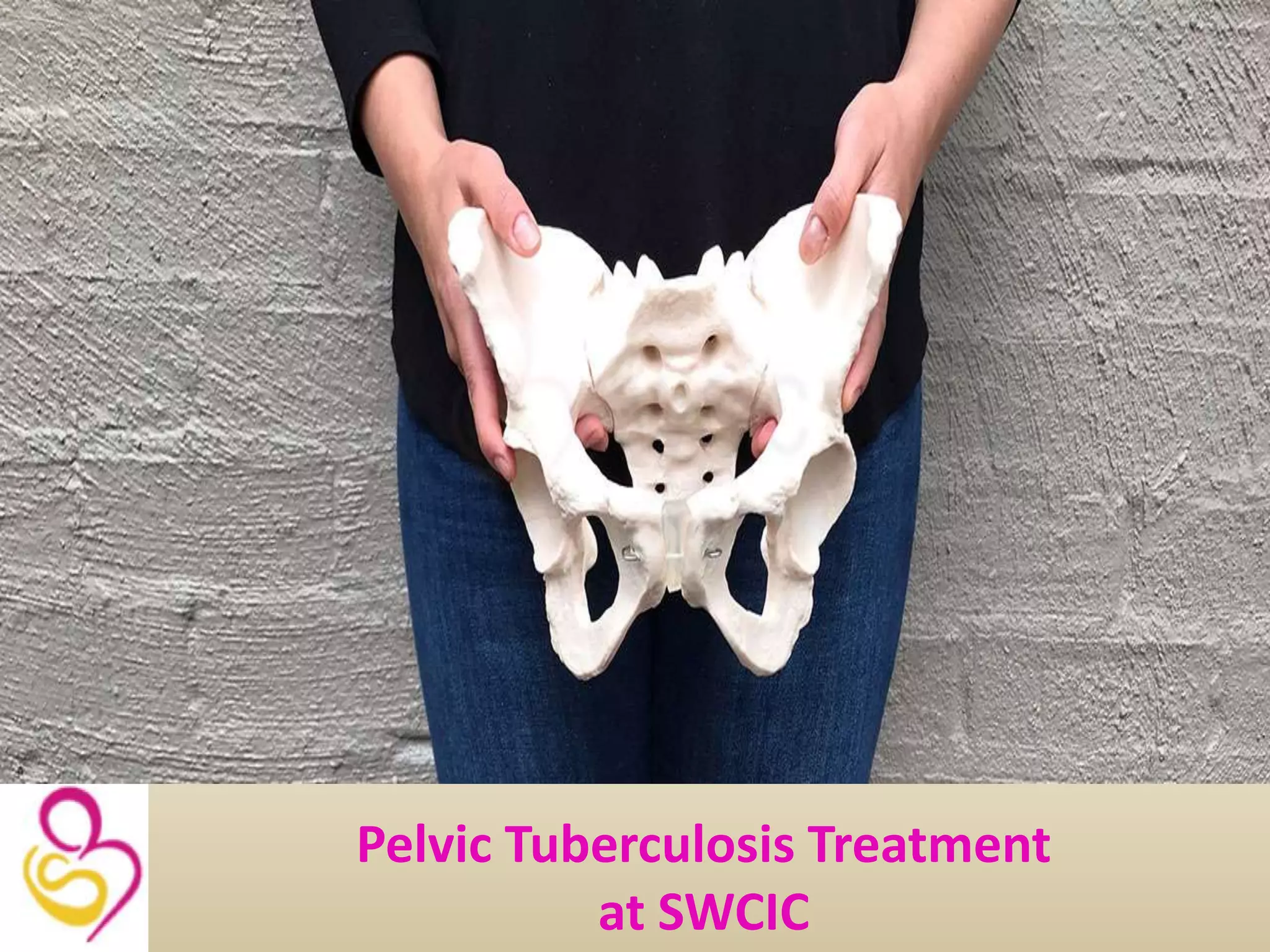 Pelvic Tuberculosis Treatment | PPTX