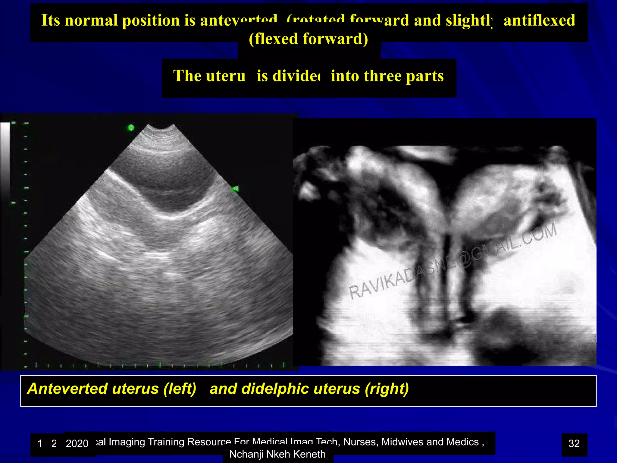 Pelvic ultrasound radiology training resource nchanji nkeh keneth | PDF
