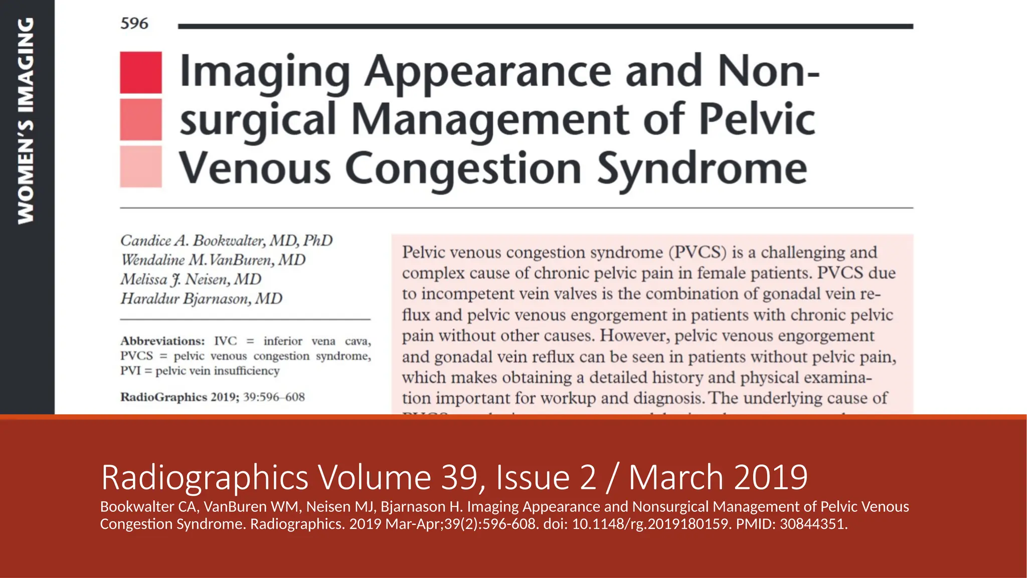 Pelvic venous congestion syndrome (PVCS) | PPTX