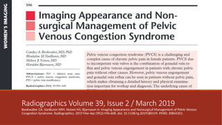 Pelvic venous congestion syndrome (PVCS) | PPTX