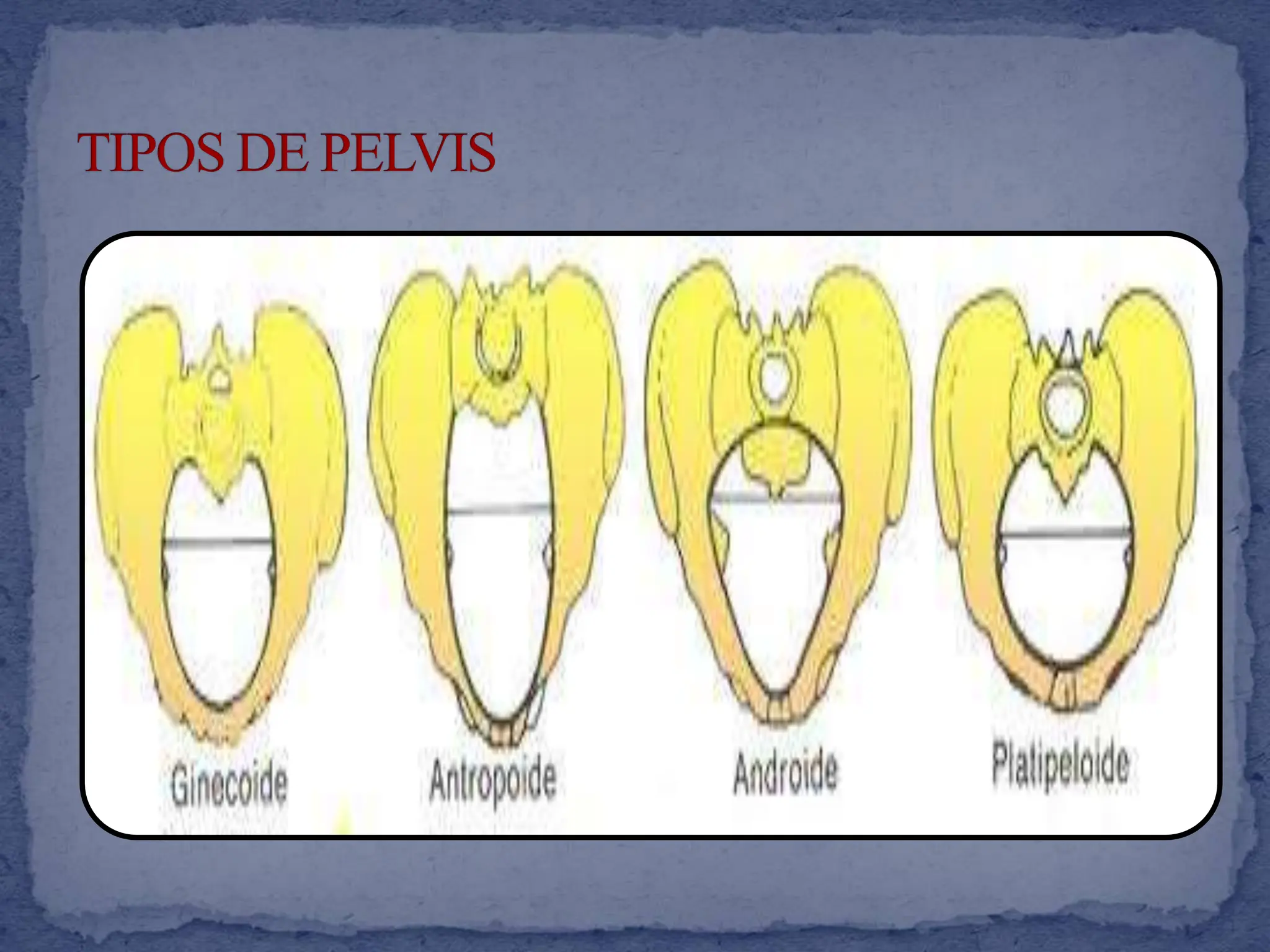 PELVIMETRÍA PELVIS VERDADERA. ANATOMÍA DE PELVIS | PPTX