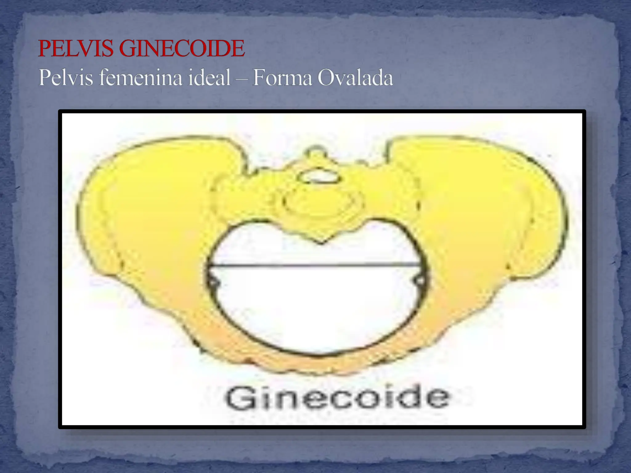 PELVIMETRÍA PELVIS VERDADERA. ANATOMÍA DE PELVIS | PPTX
