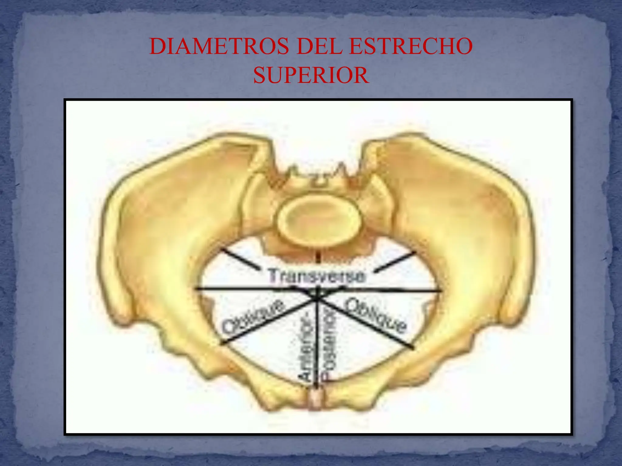 PELVIMETRÍA PELVIS VERDADERA. ANATOMÍA DE PELVIS | PPTX