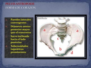 PELVIMETRÍA PELVIS VERDADERA. ANATOMÍA DE PELVIS | PPTX