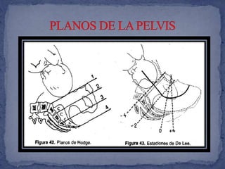 PELVIMETRÍA PELVIS VERDADERA. ANATOMÍA DE PELVIS | PPTX