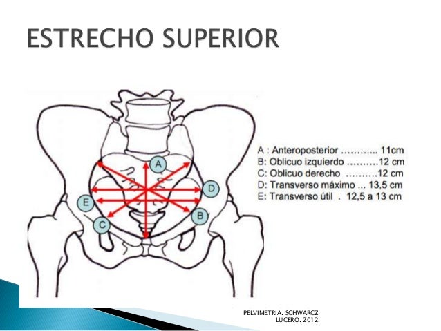 PELVIS OSEA, NOMBRE: Noemy Karla Fernandez Patón GRUPO 1 - Coggle…