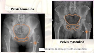 Conceptos básicos de Pelvis ósea y Pelvimetría | PPTX