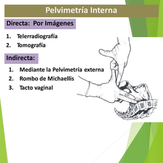 Pelvimetria interna movimientos_cardinales_ximena_beltran_alva | PPTX