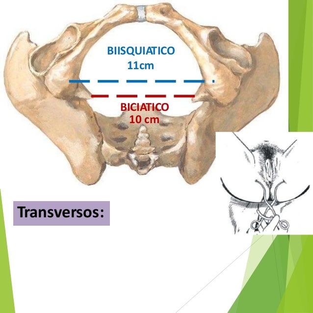 Pelvimetria interna movimientos_cardinales_ximena_beltran_alva