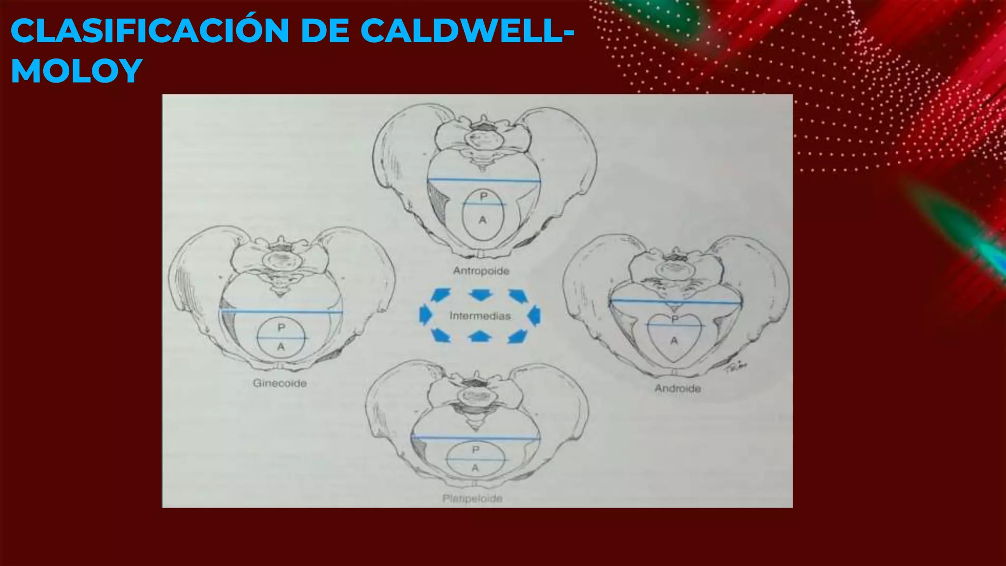 PELVIMETRÍA, PLANOS DE HODGE, DIAMETROS Y EJES DE LA PELVIS .pptx