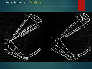 Pelvimetria y Diametros Fetales | PPTX