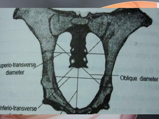 Pelvimetry, pelvic abnormalities,congenital defects of female rep.tract ...